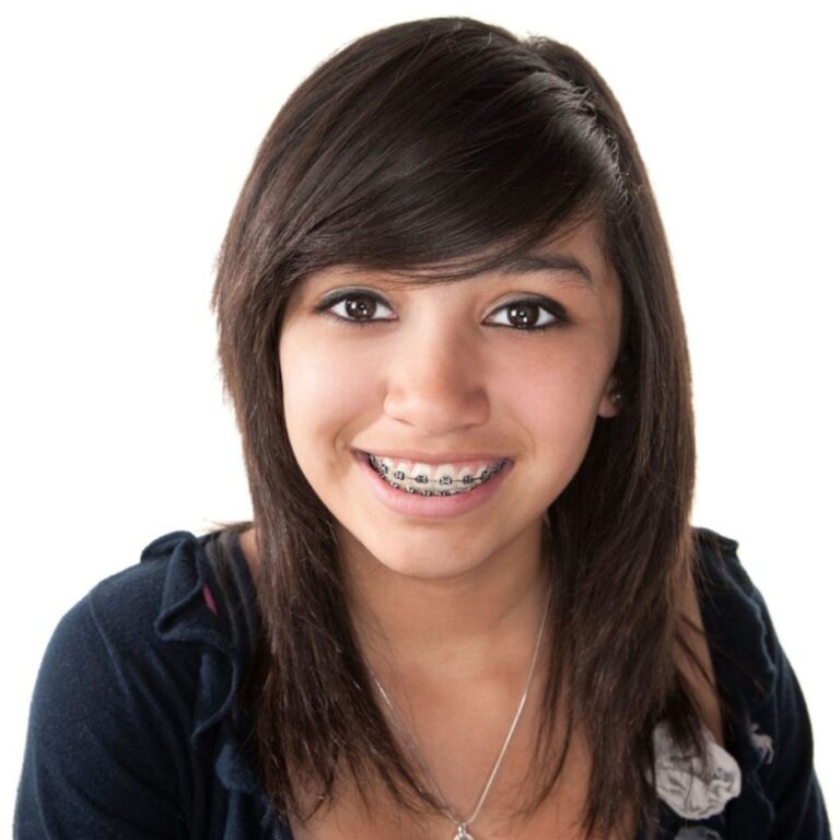 Lightforce Clear Braces | Braces Marietta | Levin Orthodontics